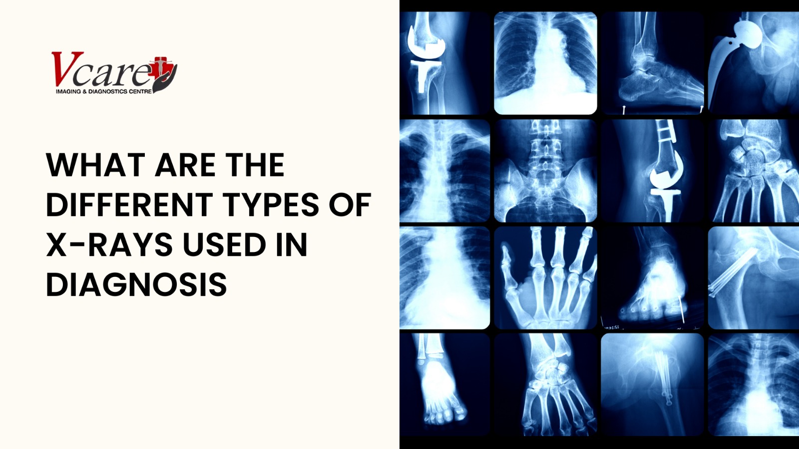 What are the different types of X-rays used in diagnosis ...